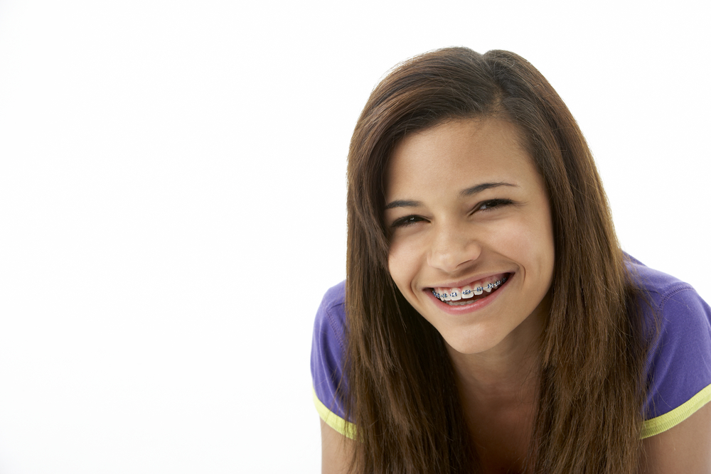 Braces FAQs - Chiang Orthodontics